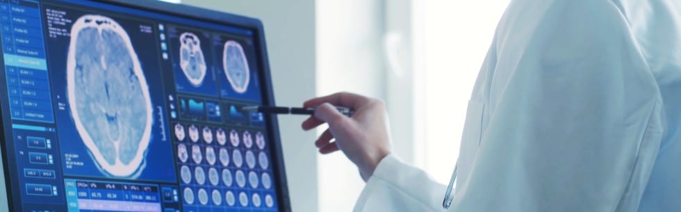 O que faz um neurologista? Conheça as principais funções desse ...